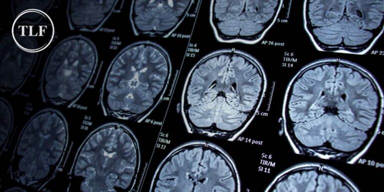 MRI Accidents - Causes, Prevention, and Legal Recourse | LBL