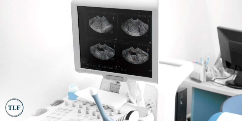 What is Bandl’s Ring? | LBL: The Medical Injury Law Firm